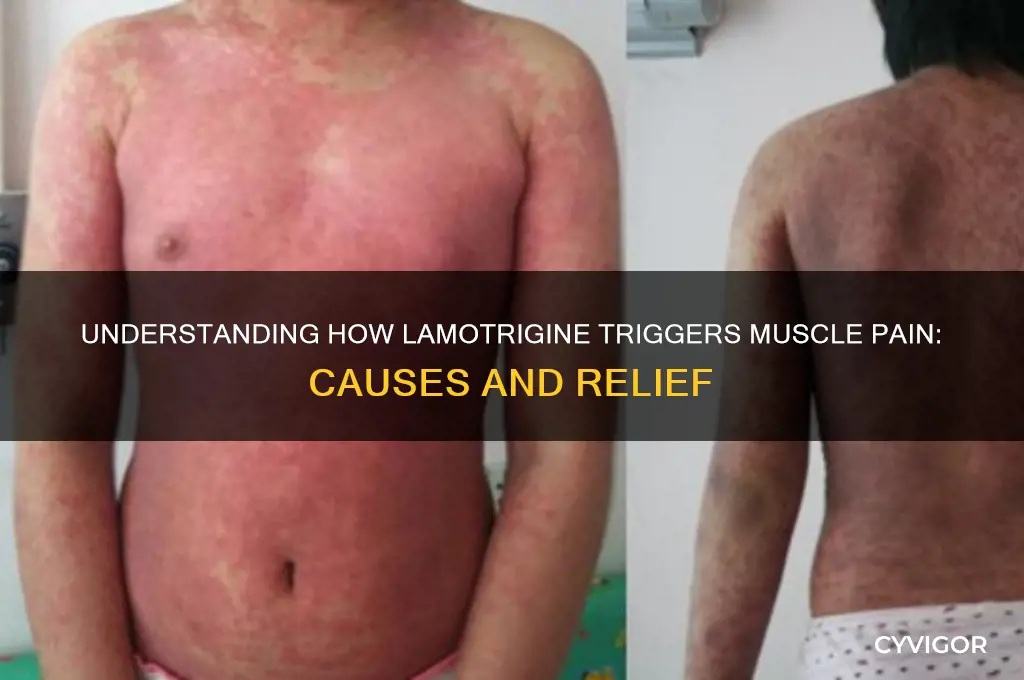 Understanding How Lamotrigine Triggers Muscle Pain: Causes And Relief ...