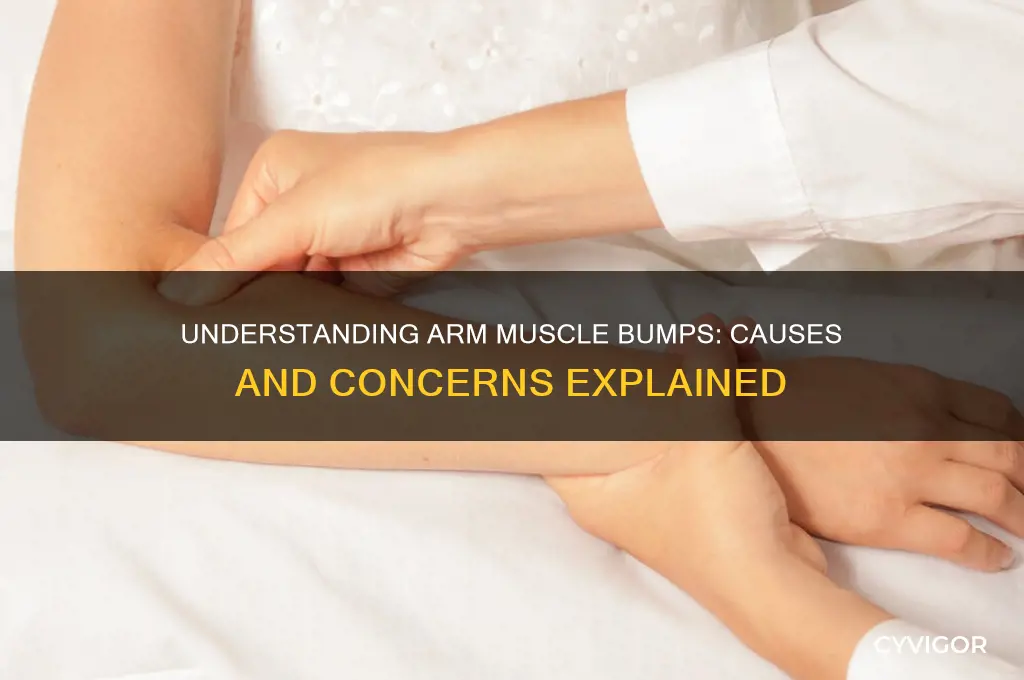 Understanding Arm Muscle Bumps: Causes And Concerns Explained | CyVigor