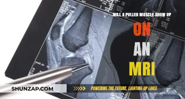 Can A Ct Scan Detect A Pulled Muscle? The Truth Revealed | CyVigor