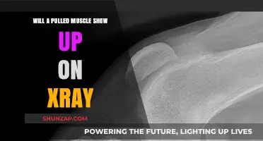 Can A Ct Scan Detect A Pulled Muscle? The Truth Revealed | CyVigor