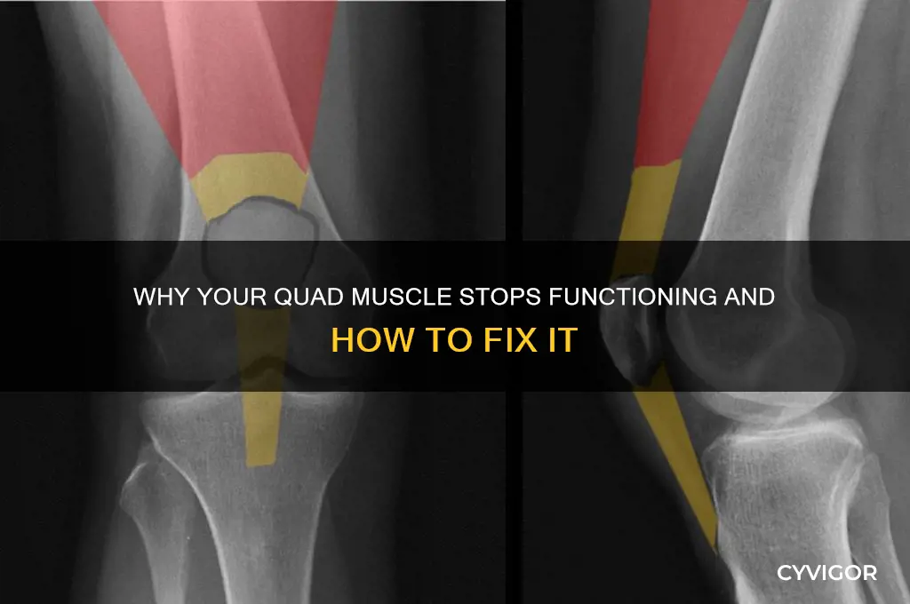 Why Your Quad Muscle Stops Functioning And How To Fix It | CyVigor