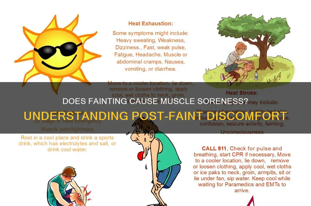Does Fainting Cause Muscle Soreness? Understanding Post-Faint ...