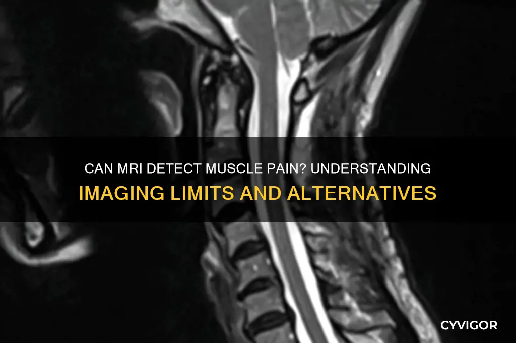 Can Mri Detect Muscle Pain? Understanding Imaging Limits And ...