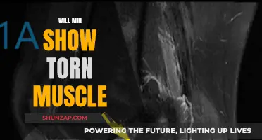 Mastering Muscle Memory: Forearm Flexes And Tricks To Remember | CyVigor