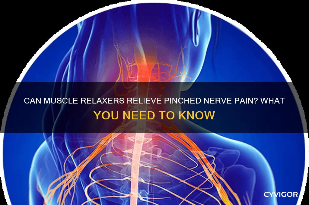 Can Muscle Relaxers Relieve Pinched Nerve Pain? What You Need To Know ...