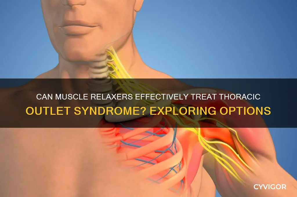 Can Muscle Relaxers Effectively Treat Thoracic Outlet Syndrome ...