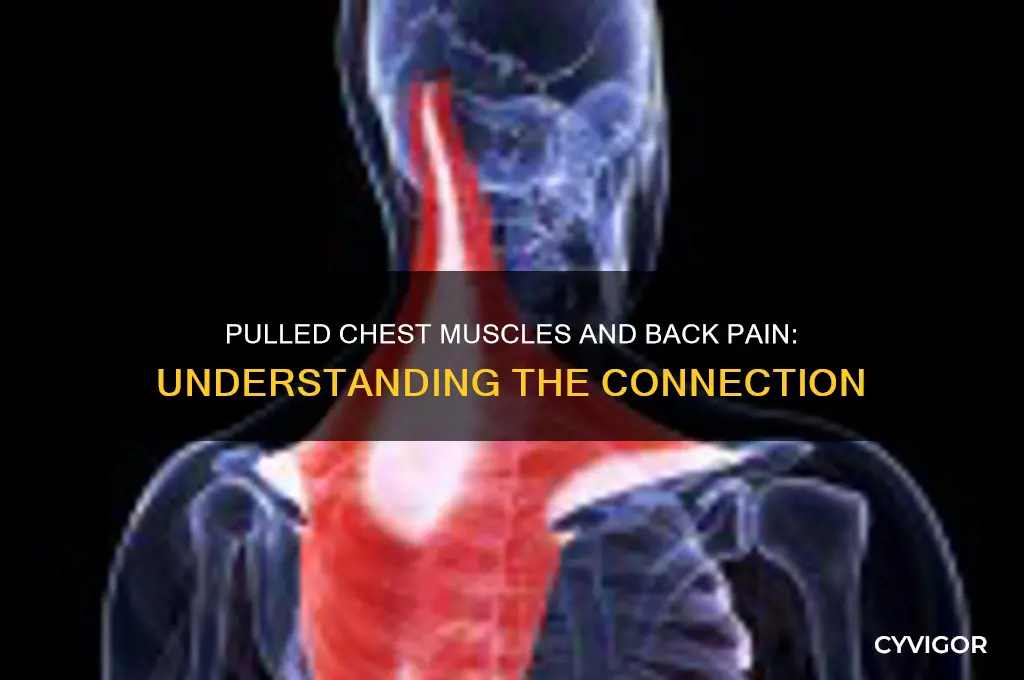 Pulled Chest Muscles And Back Pain: Understanding The Connection | CyVigor