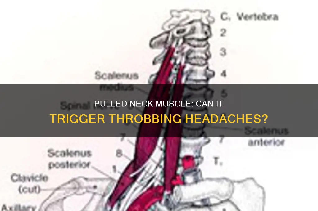 Pulled Neck Muscle: Can It Trigger Throbbing Headaches? | CyVigor
