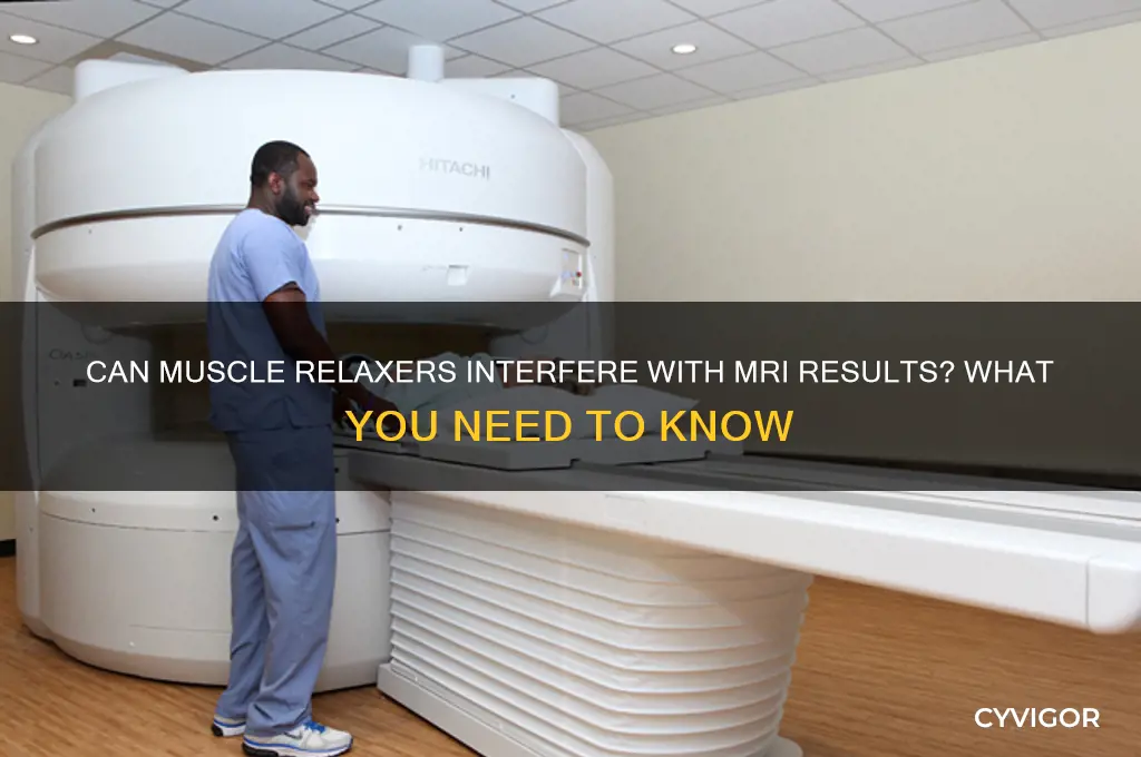 Can Muscle Relaxers Interfere With Mri Results? What You Need To Know ...