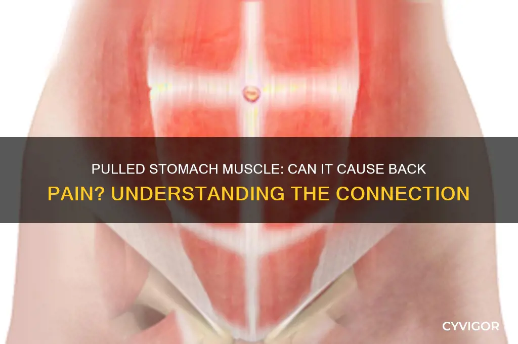 Pulled Stomach Muscle: Can It Cause Back Pain? Understanding The ...
